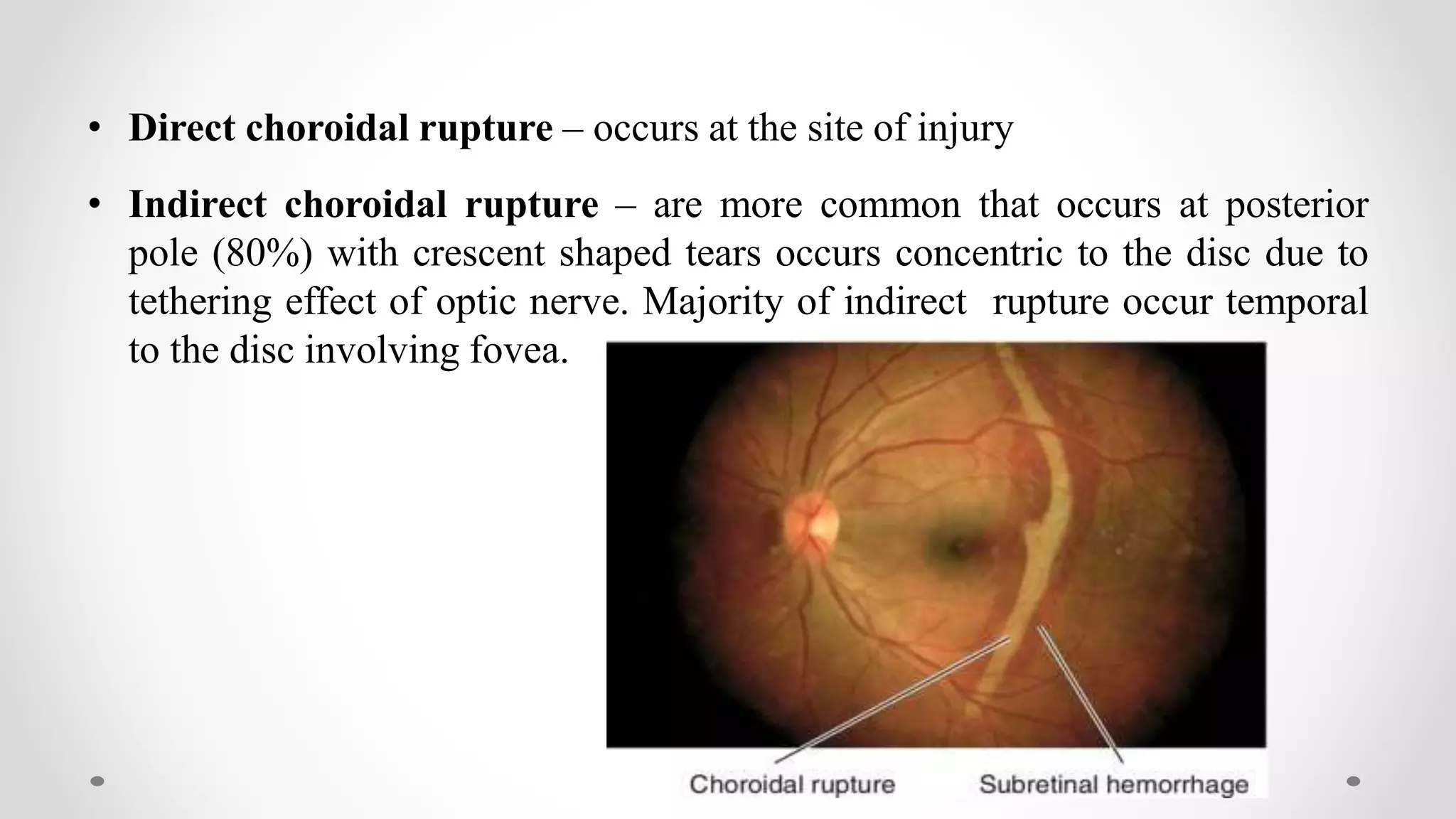 Posterior segment manifestations of blunt trauma-1.pptx