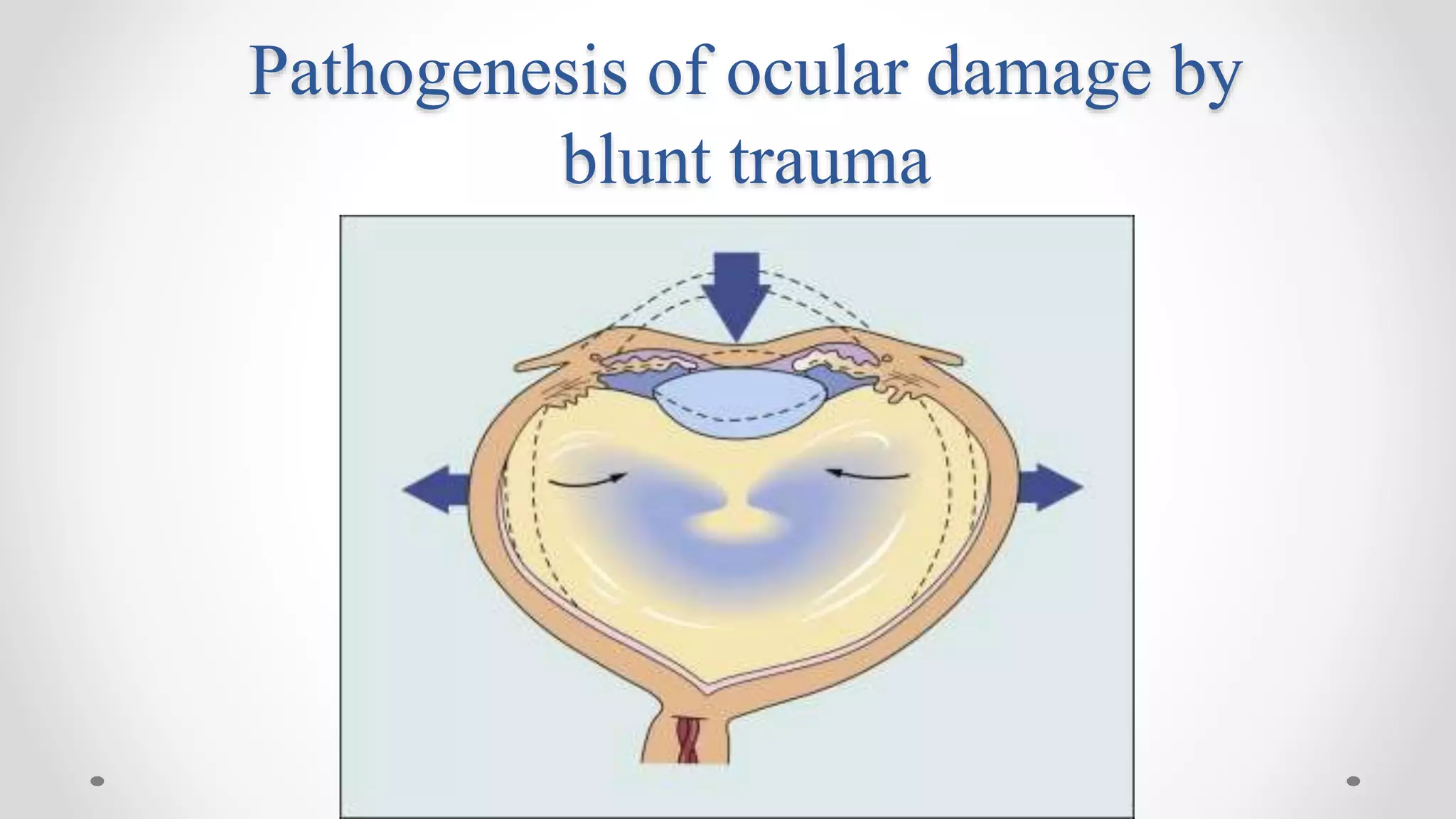 Posterior segment manifestations of blunt trauma-1.pptx