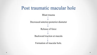 Posterior segment manifestations of blunt trauma-1.pptx