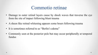 Posterior segment manifestations of blunt trauma-1.pptx
