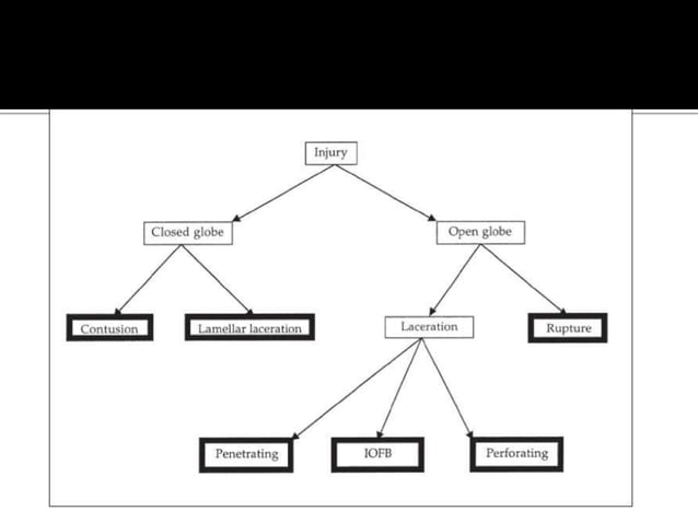 Posterior segment manifestations of blunt trauma | PPT | Free Download