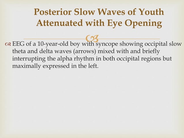 Posterior slow waves of youth | PPTX