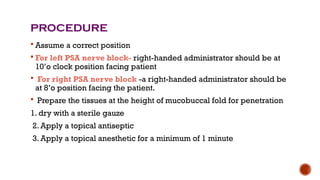 Posterior superior alveolar nerve block seminar.pptx