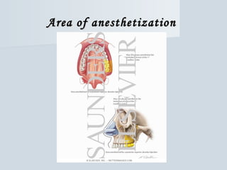 Posterior superior alveolar (psa) nerve block | PPT