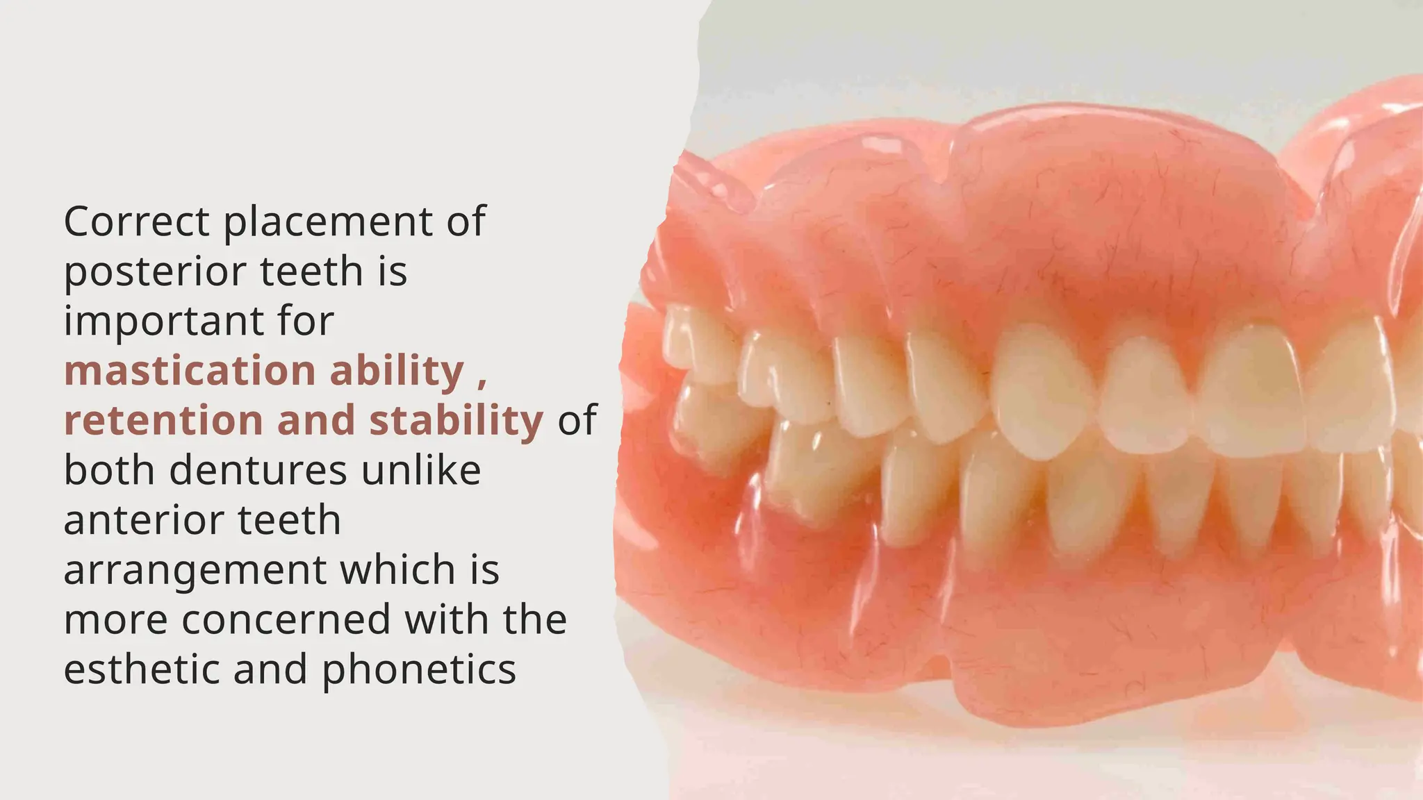 complete dentures posterior teeth arrangement.pptx