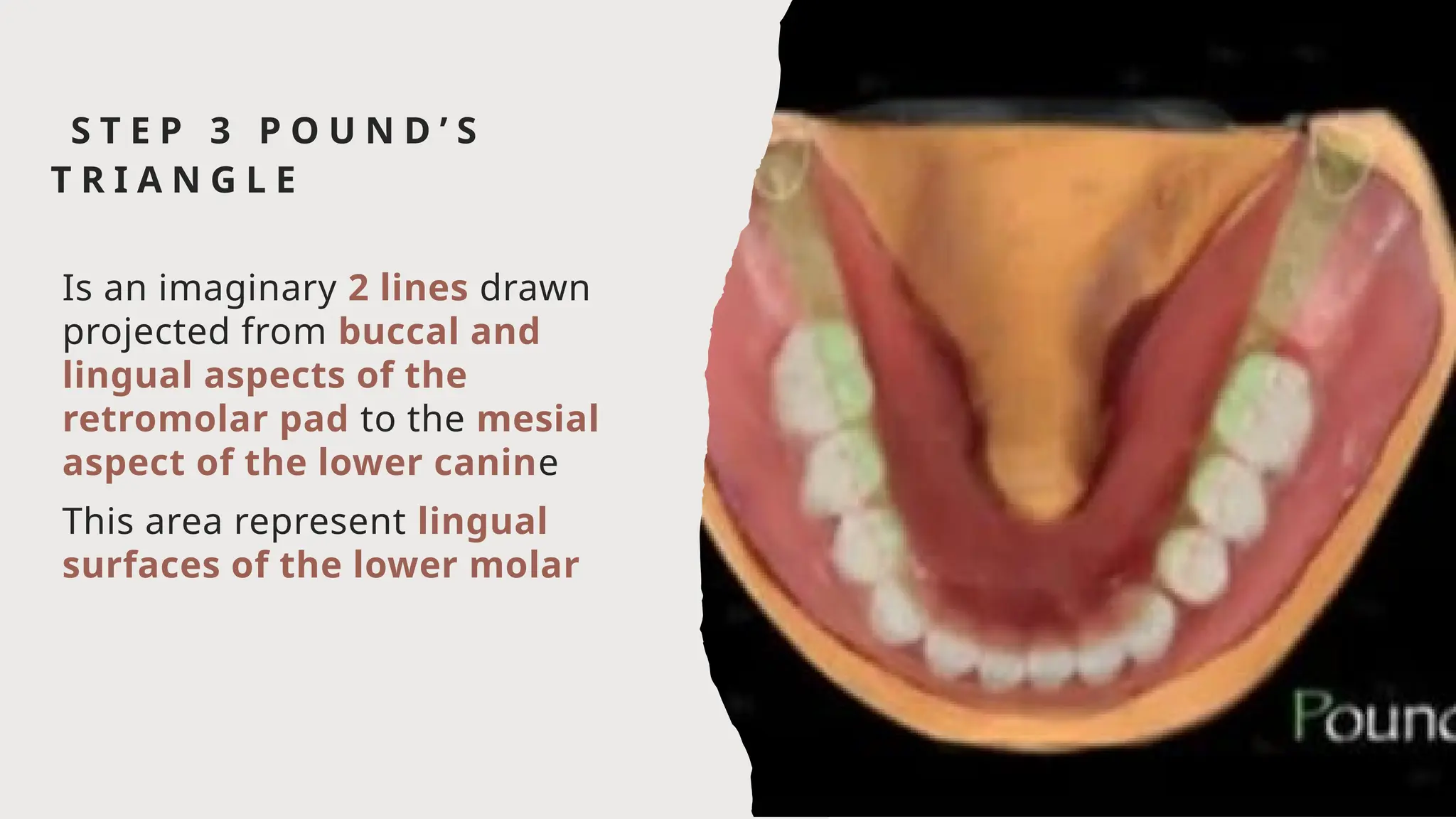 complete dentures posterior teeth arrangement.pptx