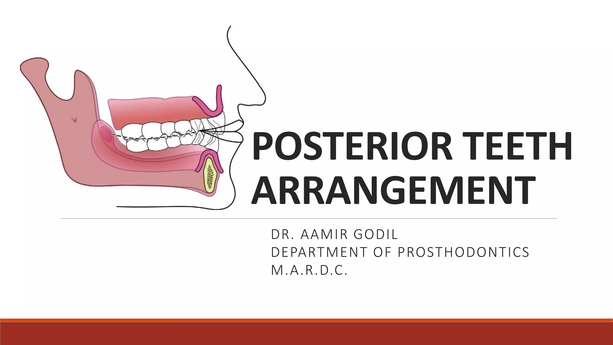 Posterior Teeth Arrangement | PDF