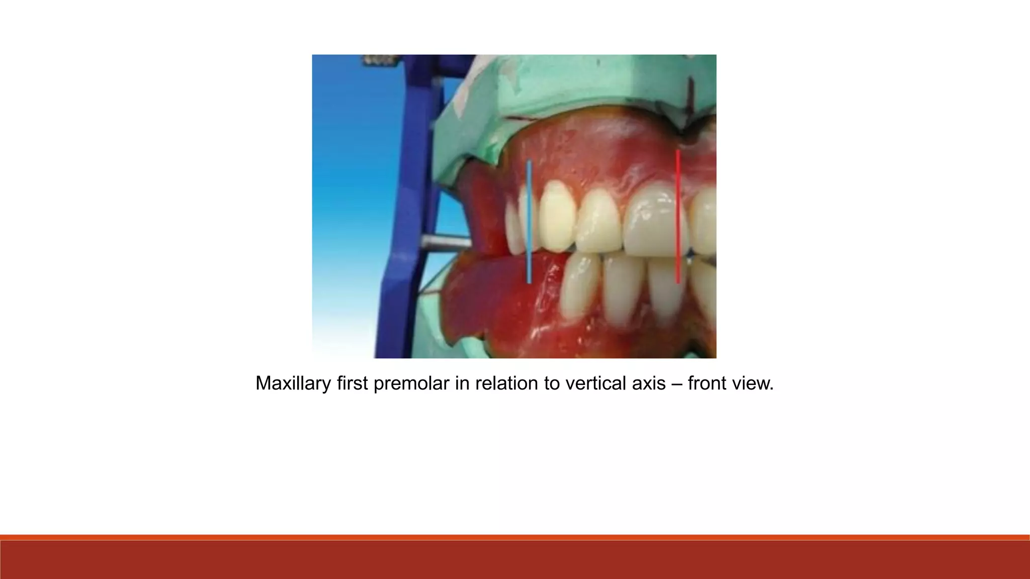 Posterior Teeth Arrangement | PDF
