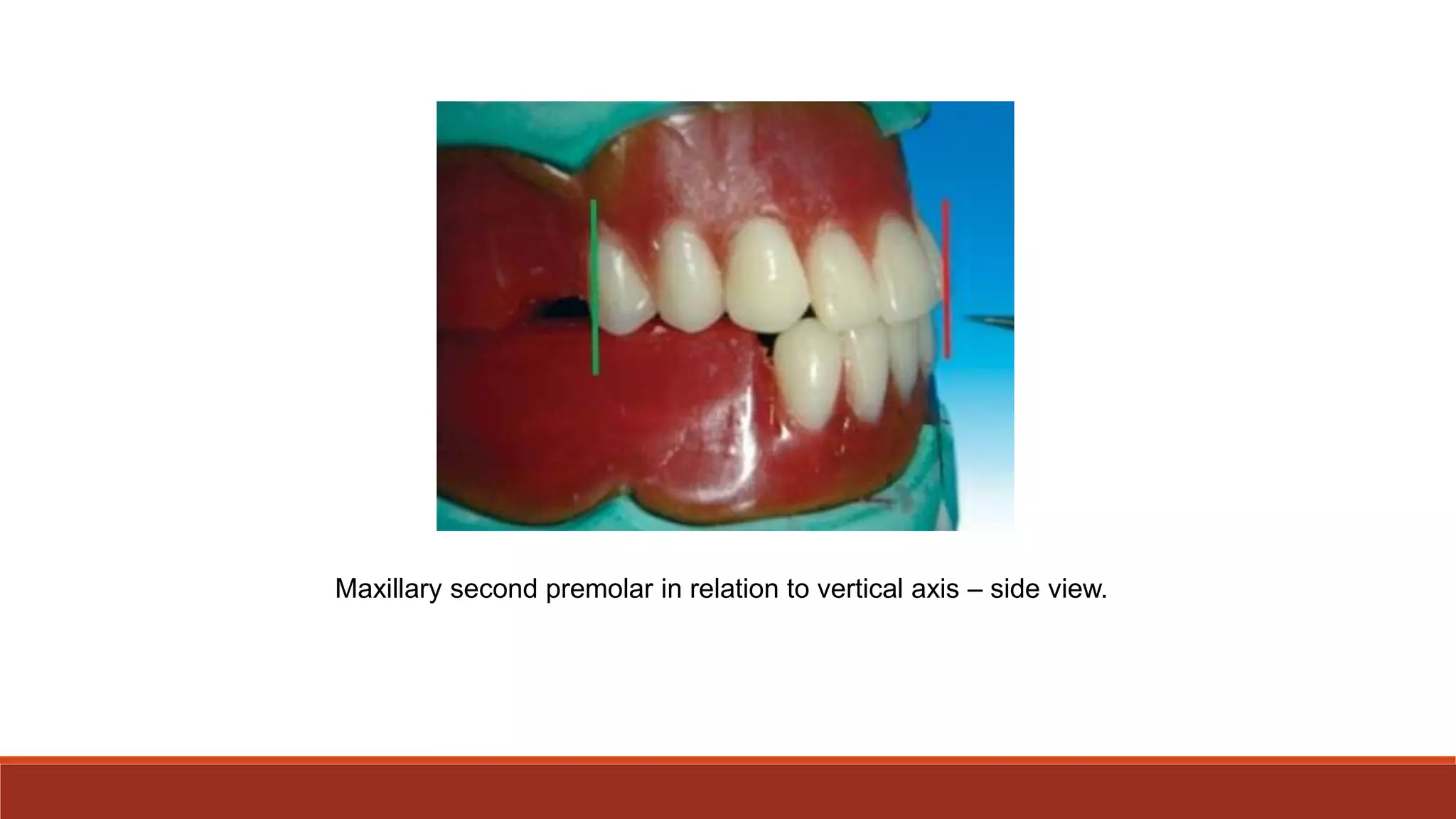 Posterior Teeth Arrangement | PDF