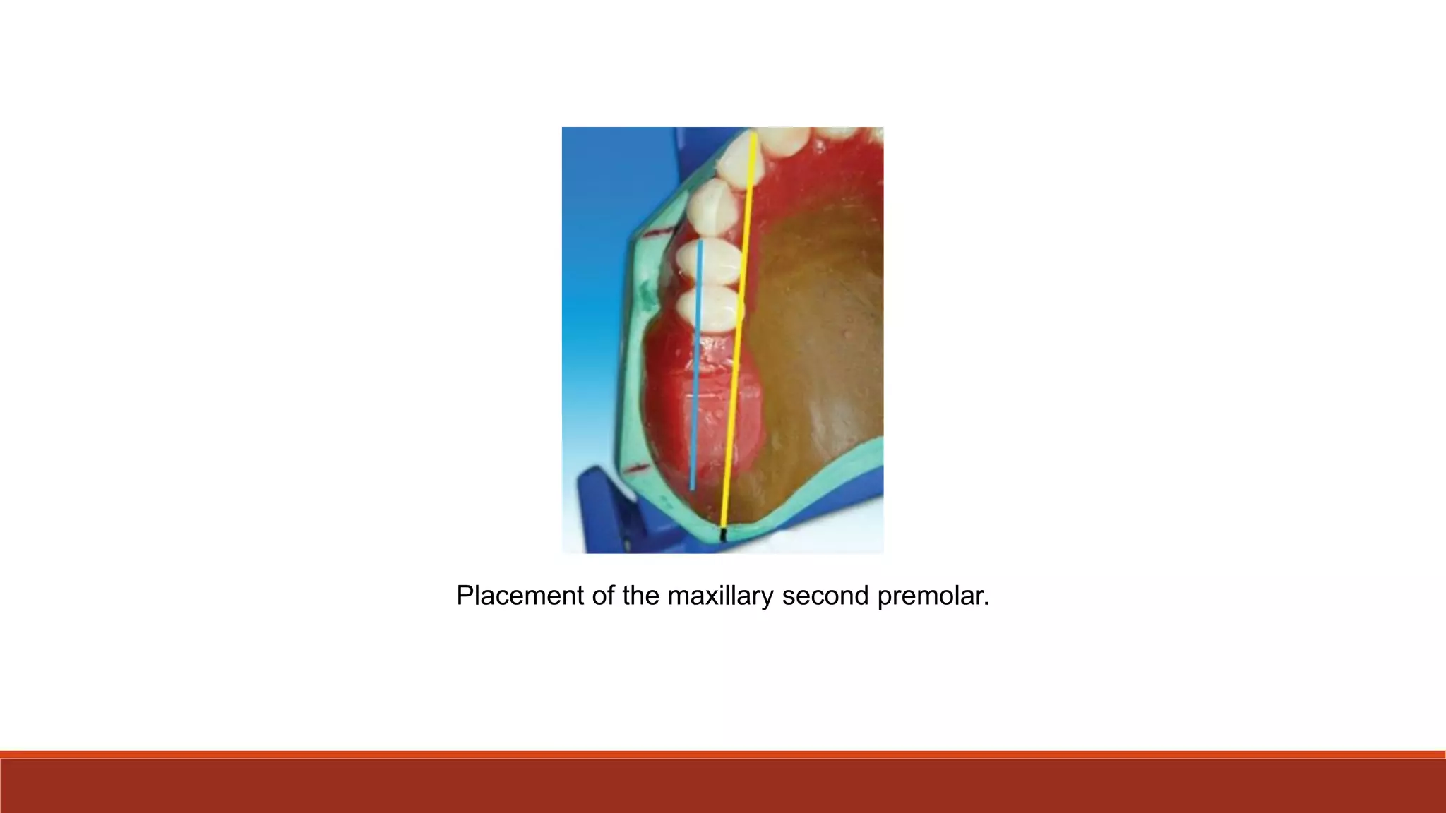 Posterior Teeth Arrangement | PDF