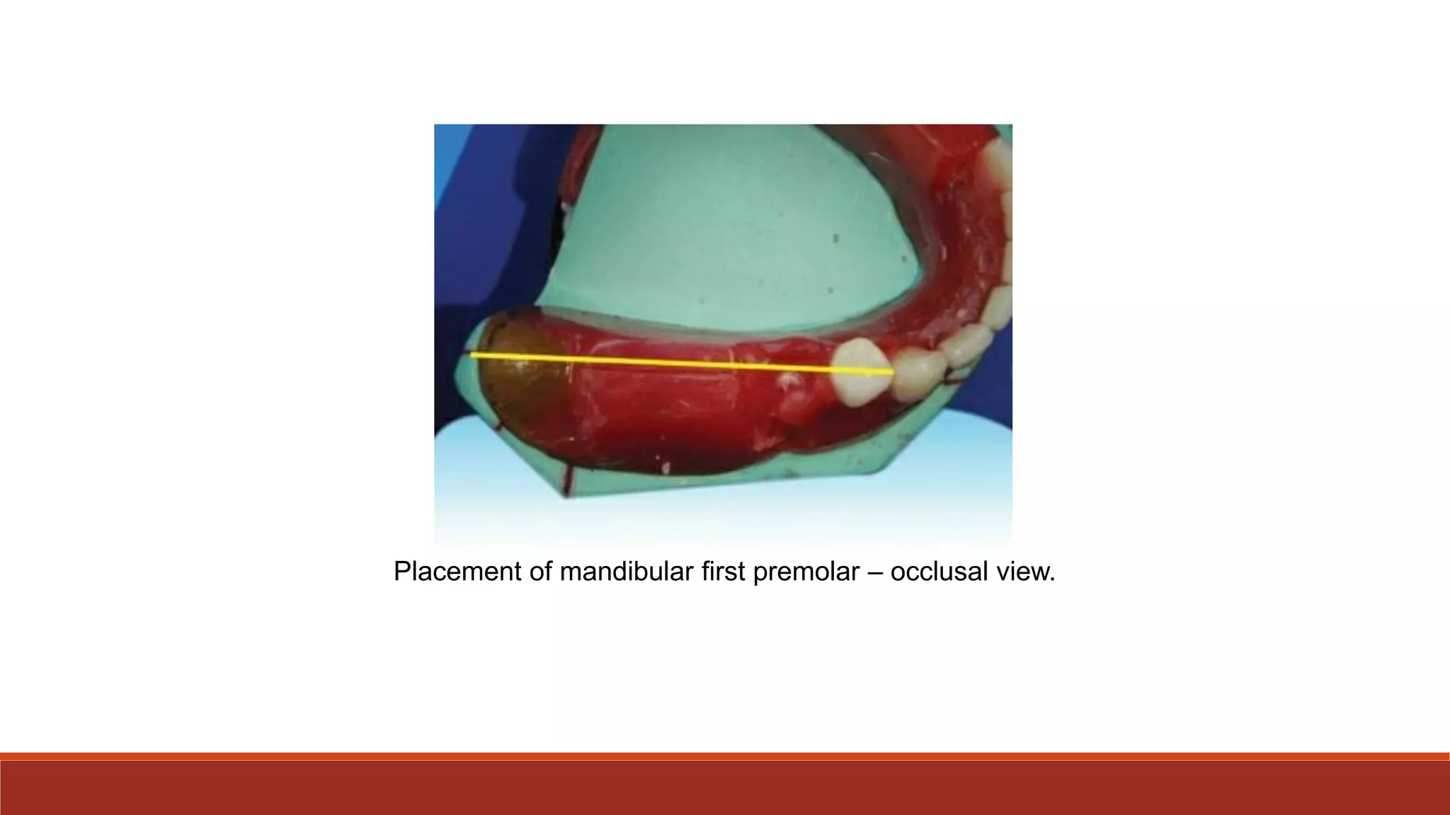 Posterior Teeth Arrangement | PDF
