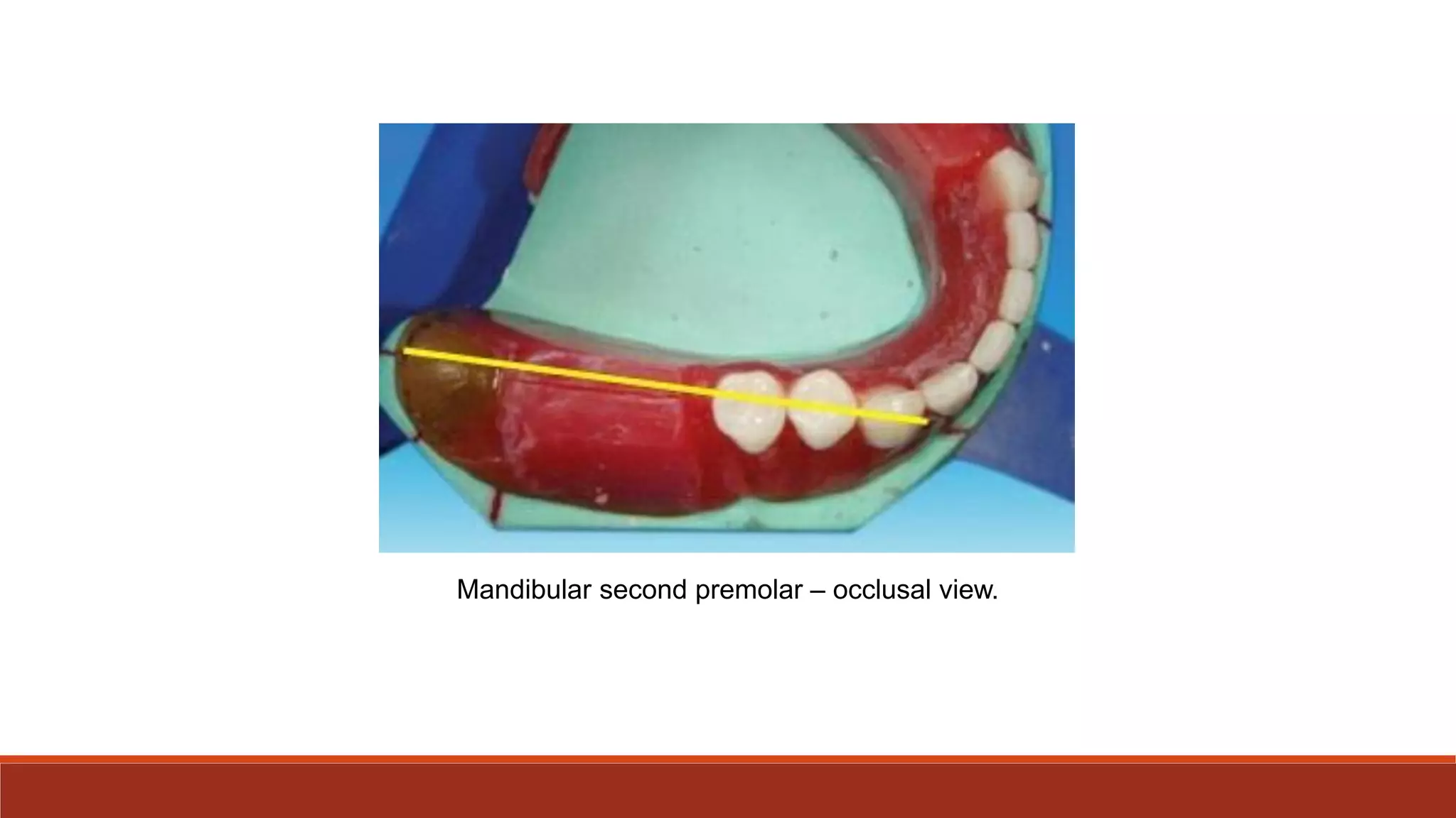 Posterior Teeth Arrangement | PDF