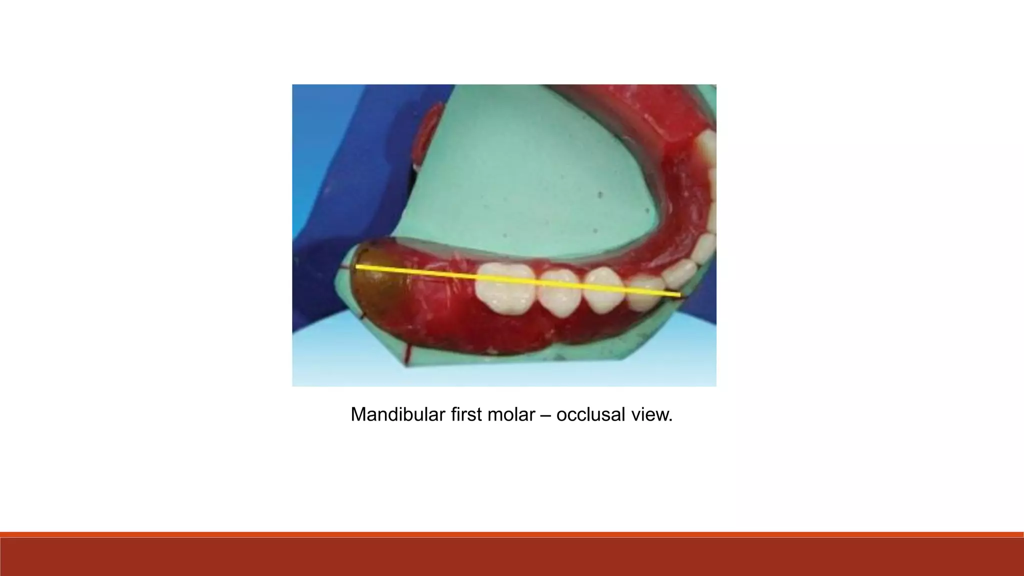 Posterior Teeth Arrangement | PDF