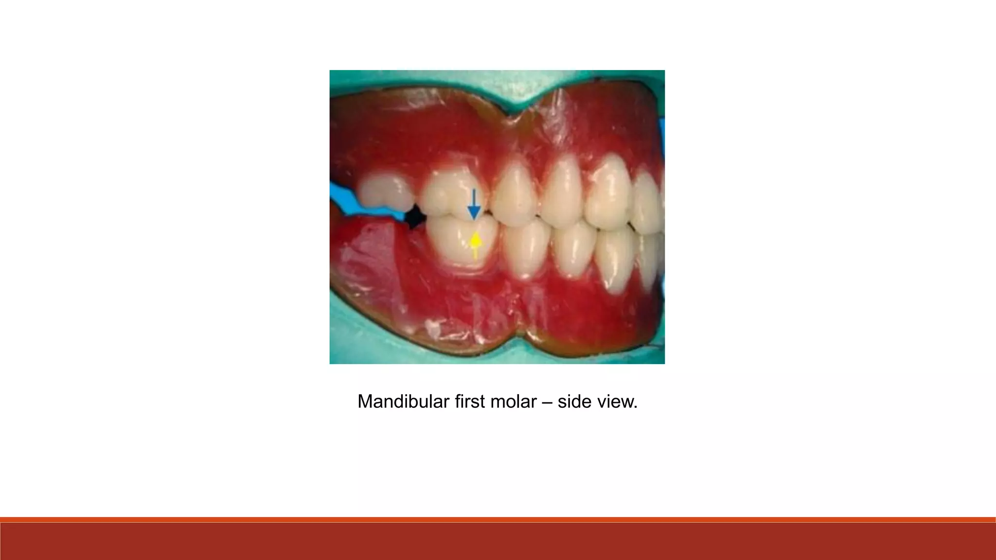 Posterior Teeth Arrangement | PDF