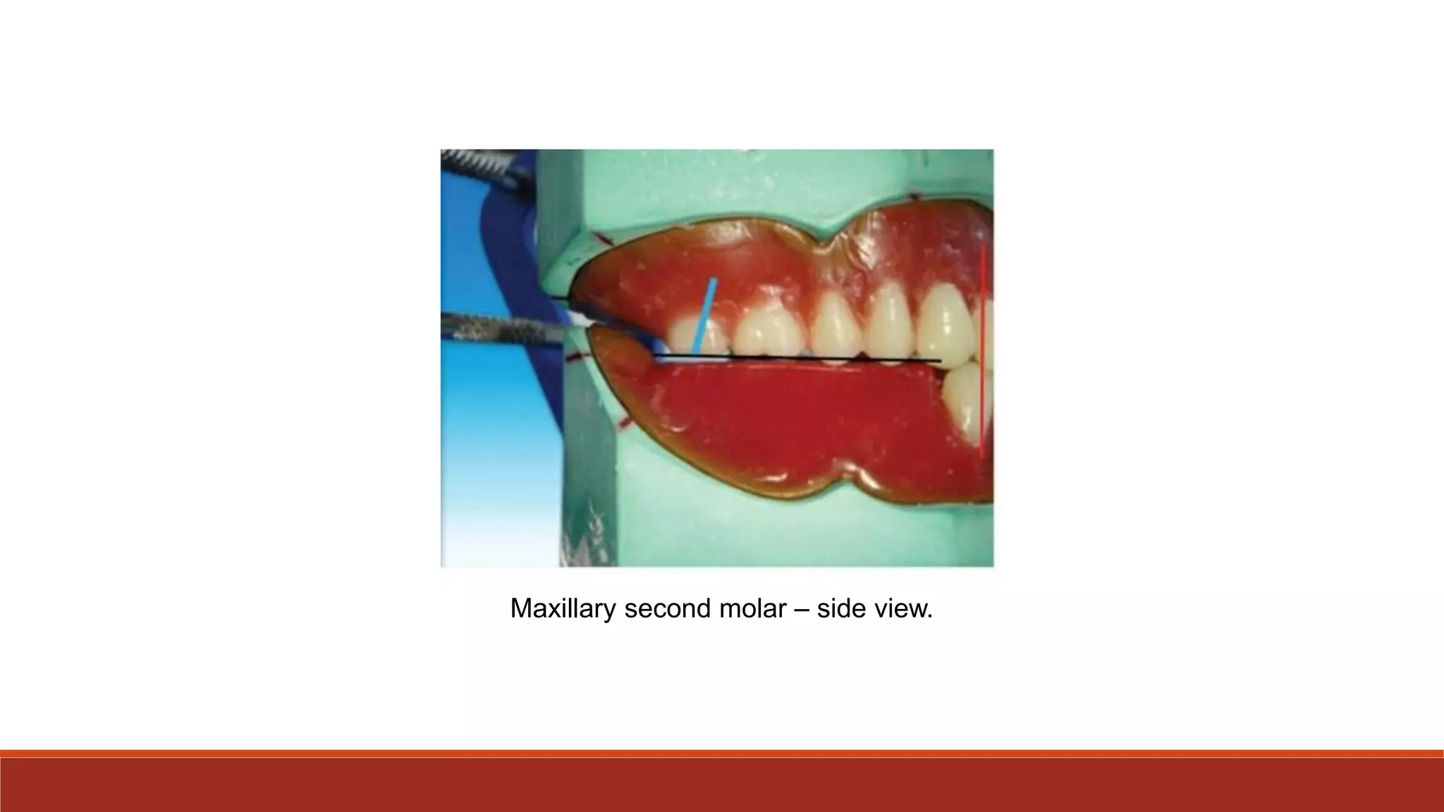 Posterior Teeth Arrangement | PDF