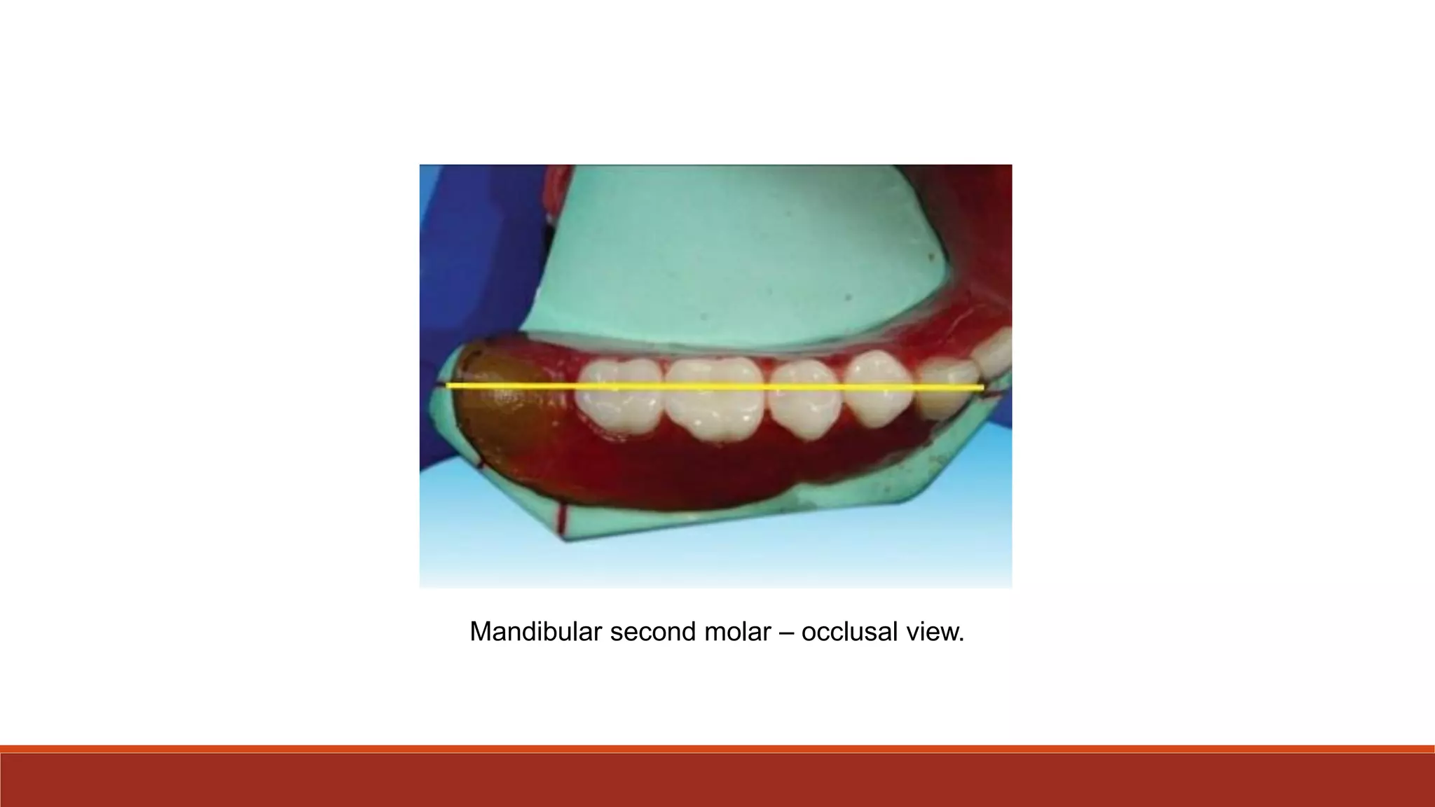 Posterior Teeth Arrangement | PDF