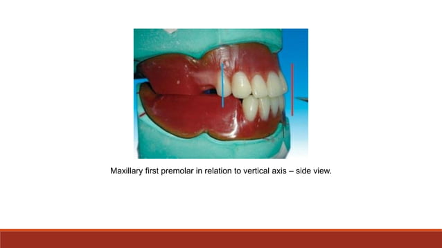 Posterior Teeth Arrangement | PDF
