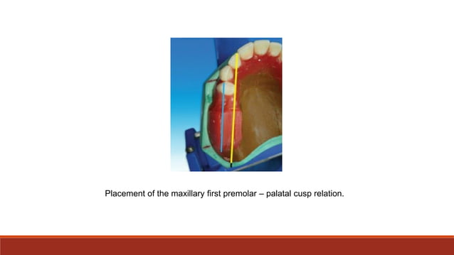 Posterior Teeth Arrangement | PDF