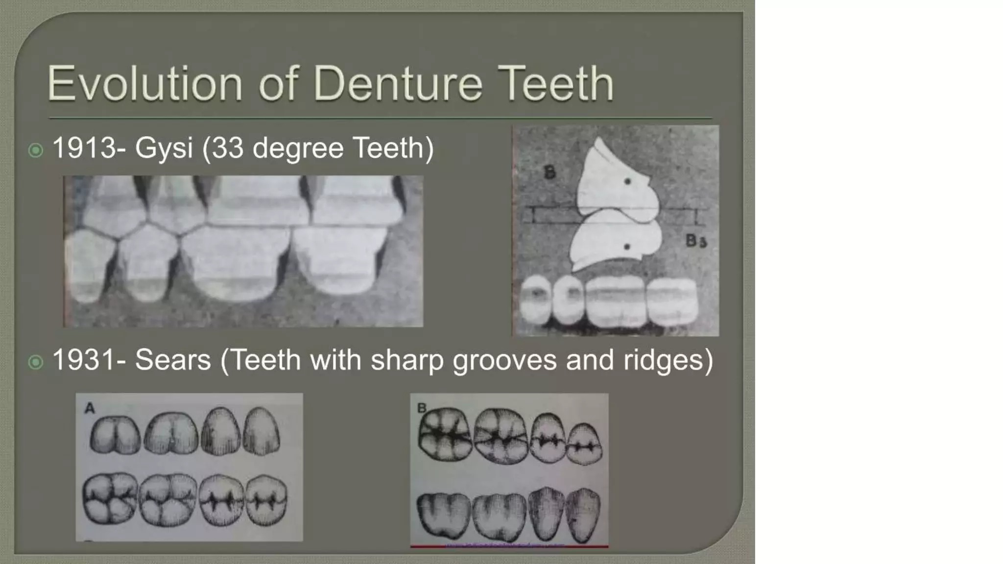 POSTERIOR TEETH SELECTION IN CD.pptx