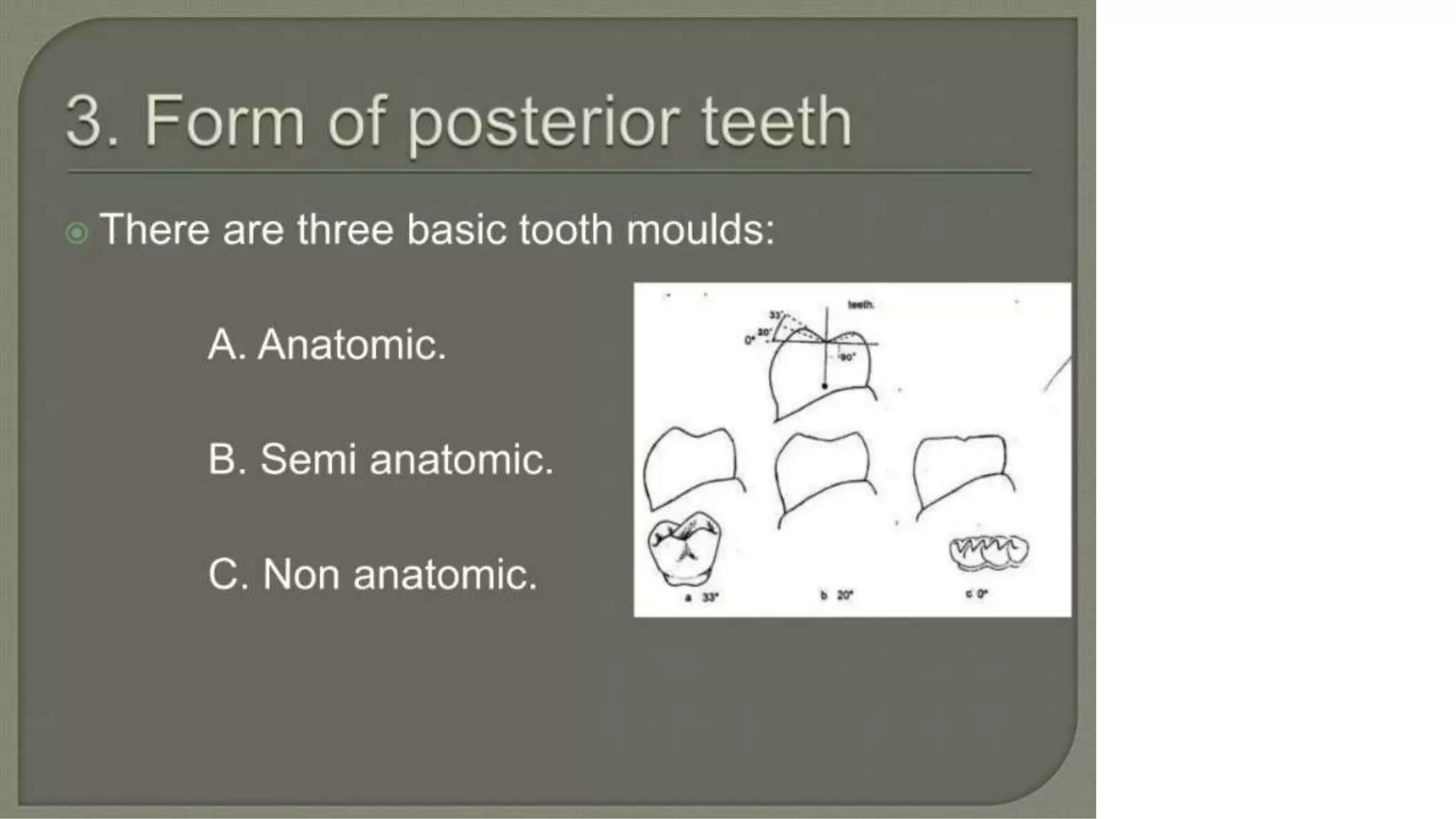 POSTERIOR TEETH SELECTION IN CD.pptx