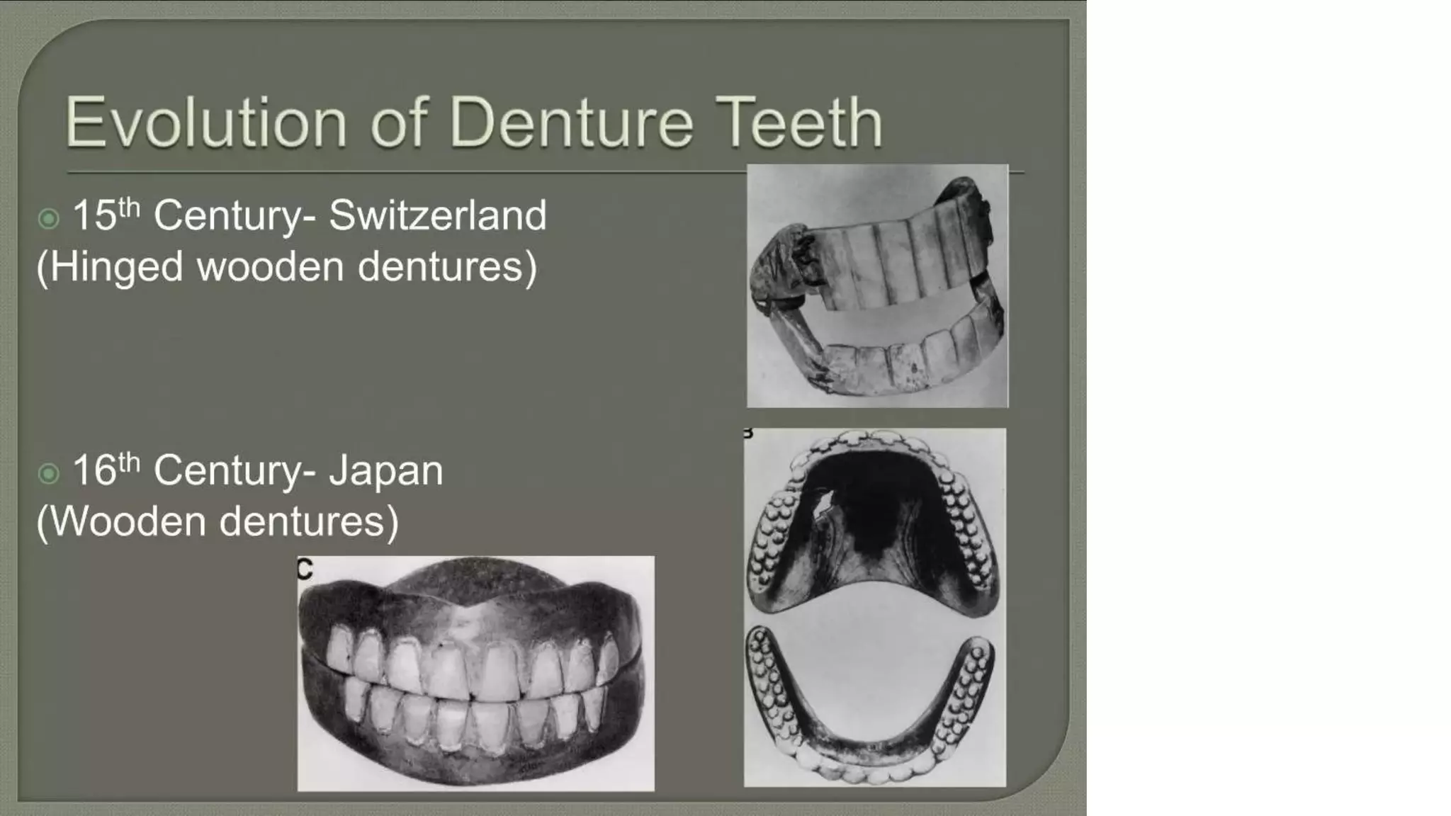 POSTERIOR TEETH SELECTION IN CD.pptx