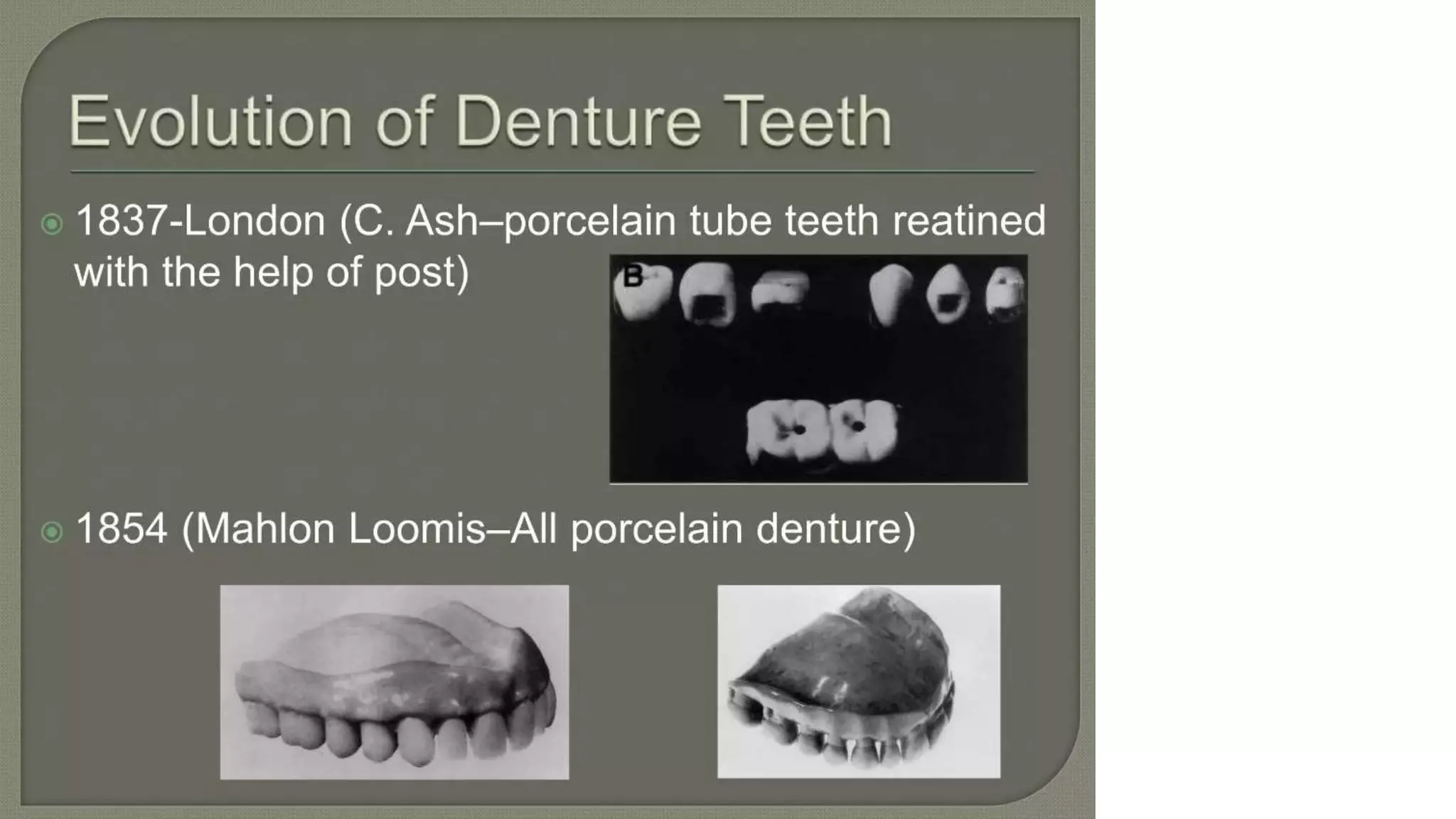 POSTERIOR TEETH SELECTION IN CD.pptx