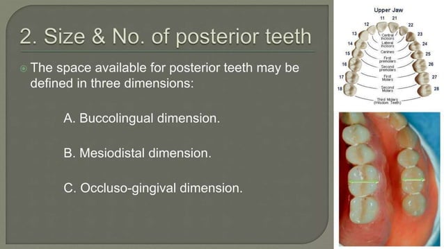 POSTERIOR TEETH SELECTION IN CD.pptx