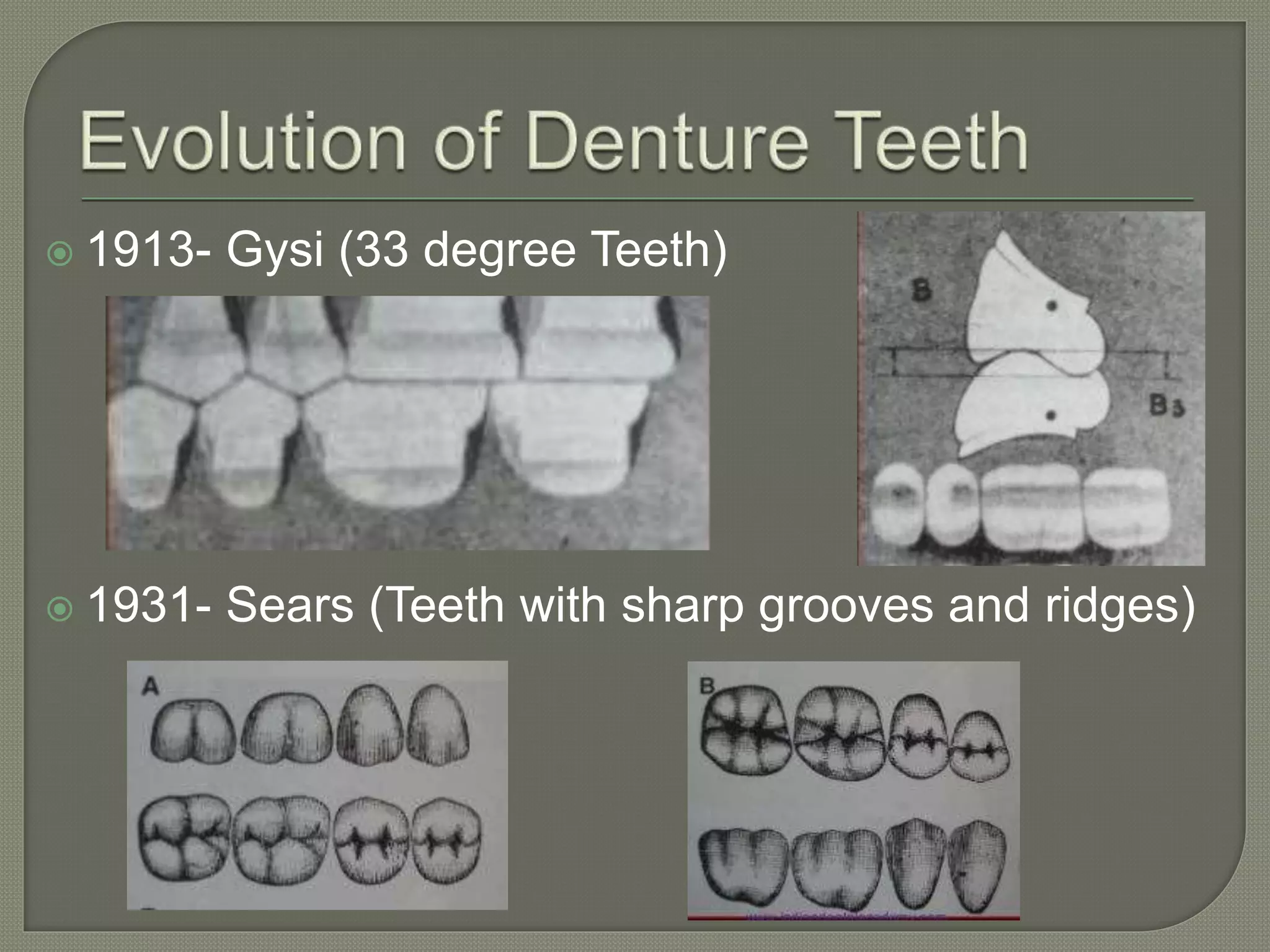 Posterior Teeth Selection in Complete Denture | PPT