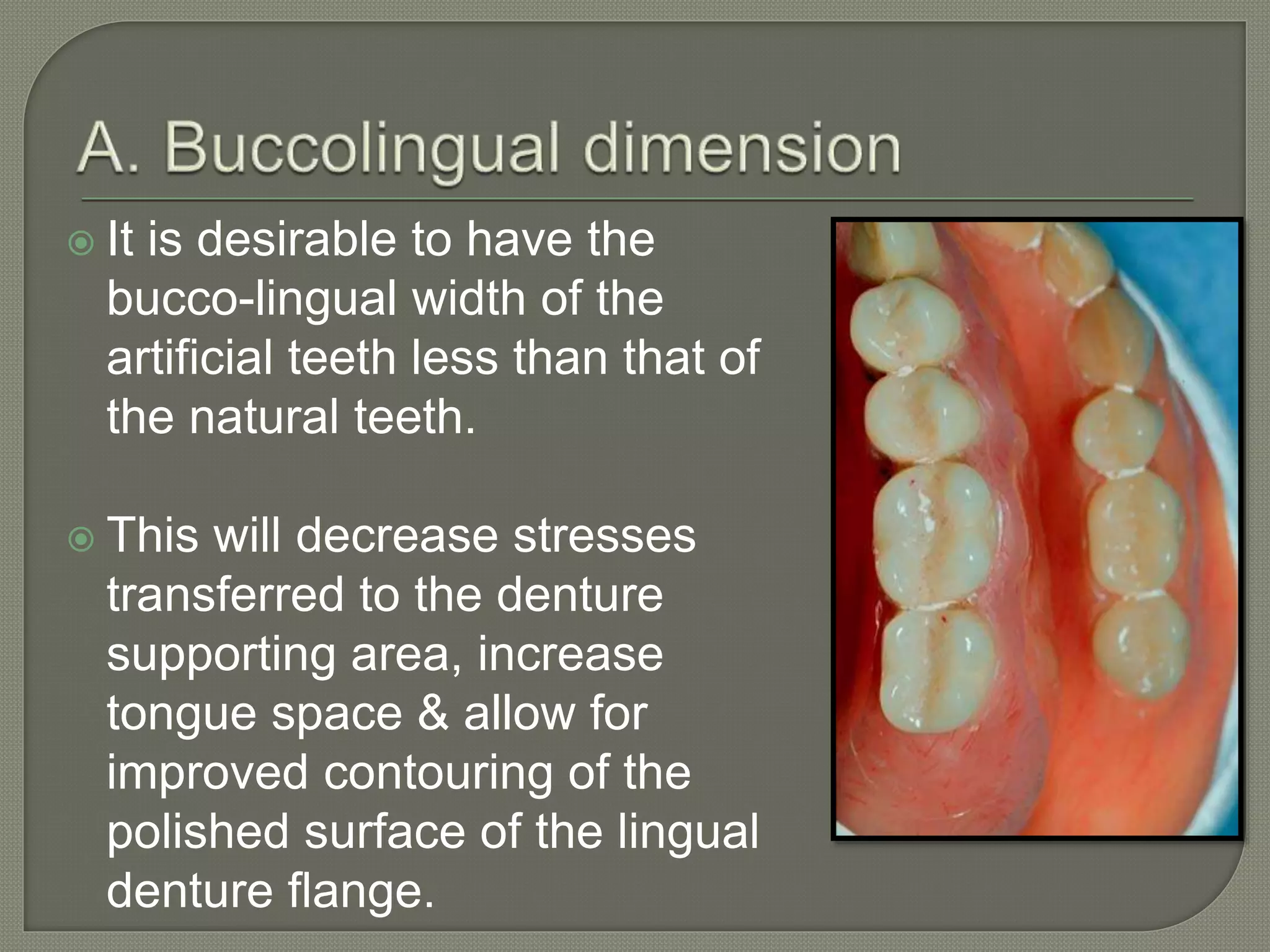 Posterior Teeth Selection in Complete Denture | PPT