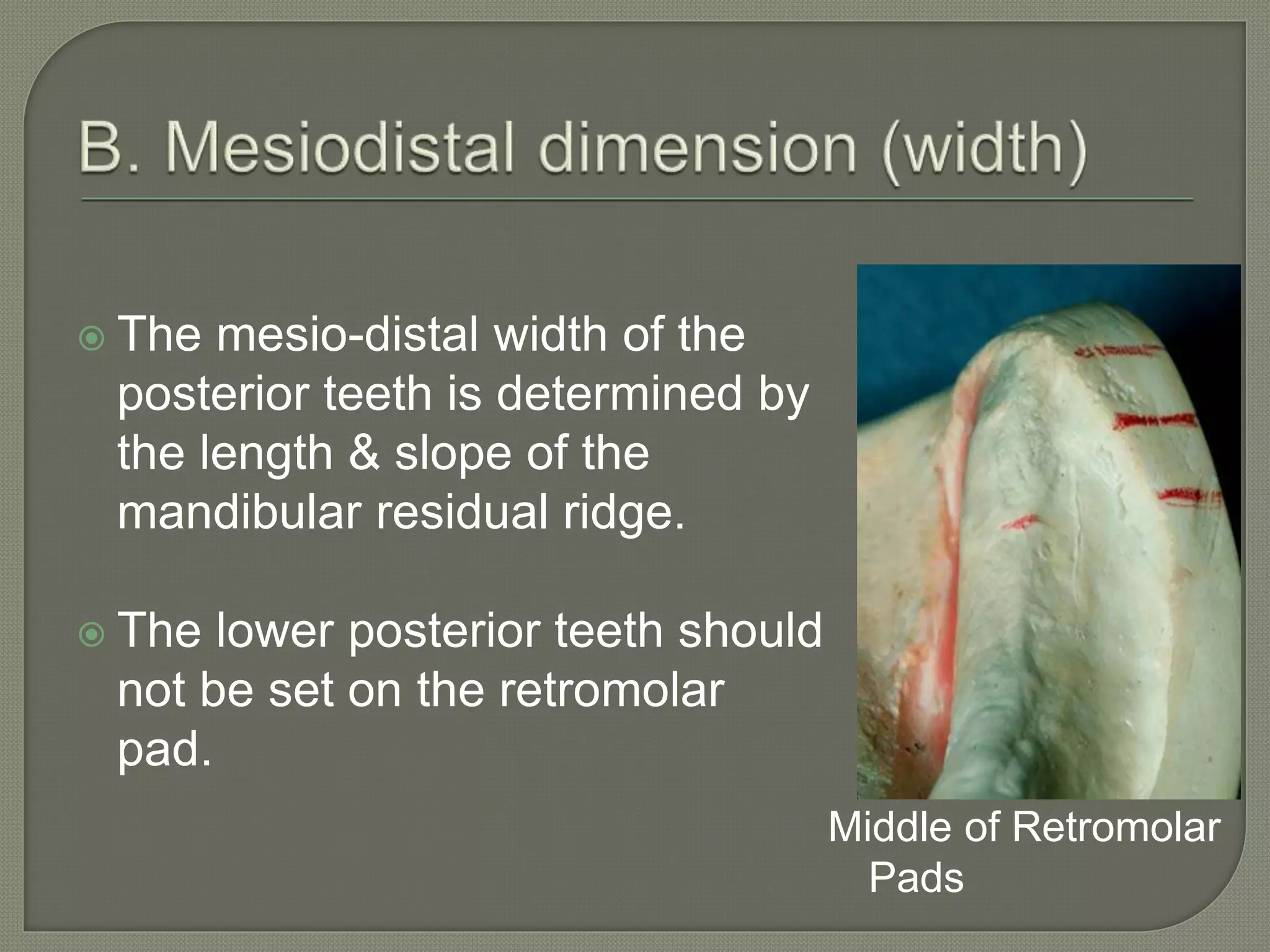 Posterior Teeth Selection in Complete Denture | PPT