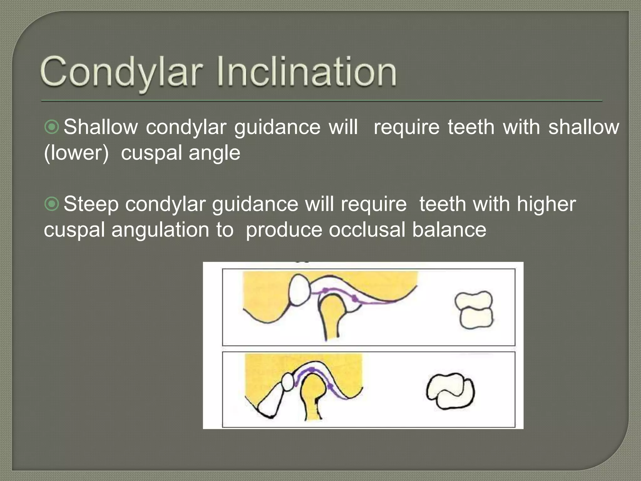 Posterior Teeth Selection in Complete Denture | PPT