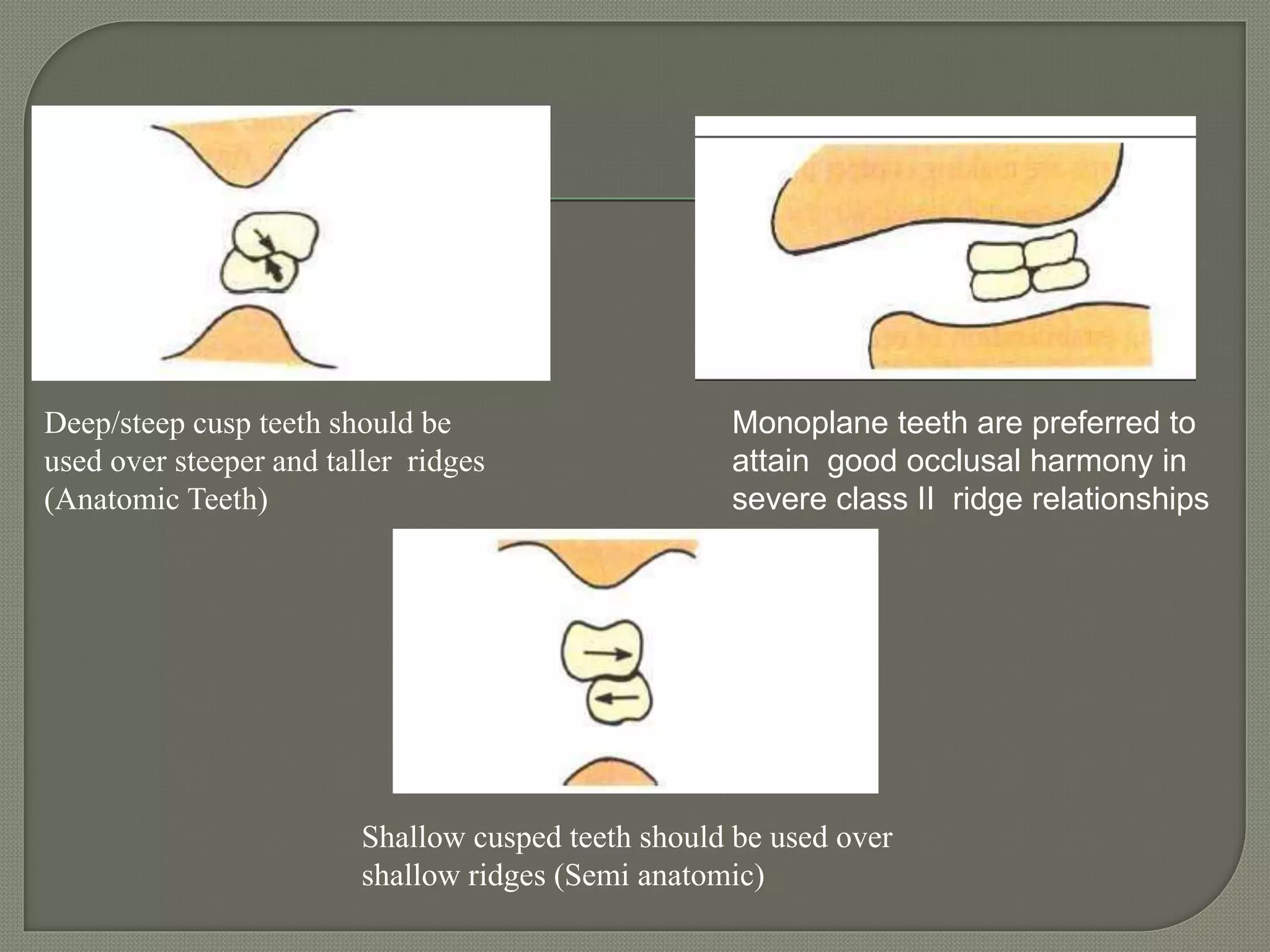 Posterior Teeth Selection in Complete Denture | PPT