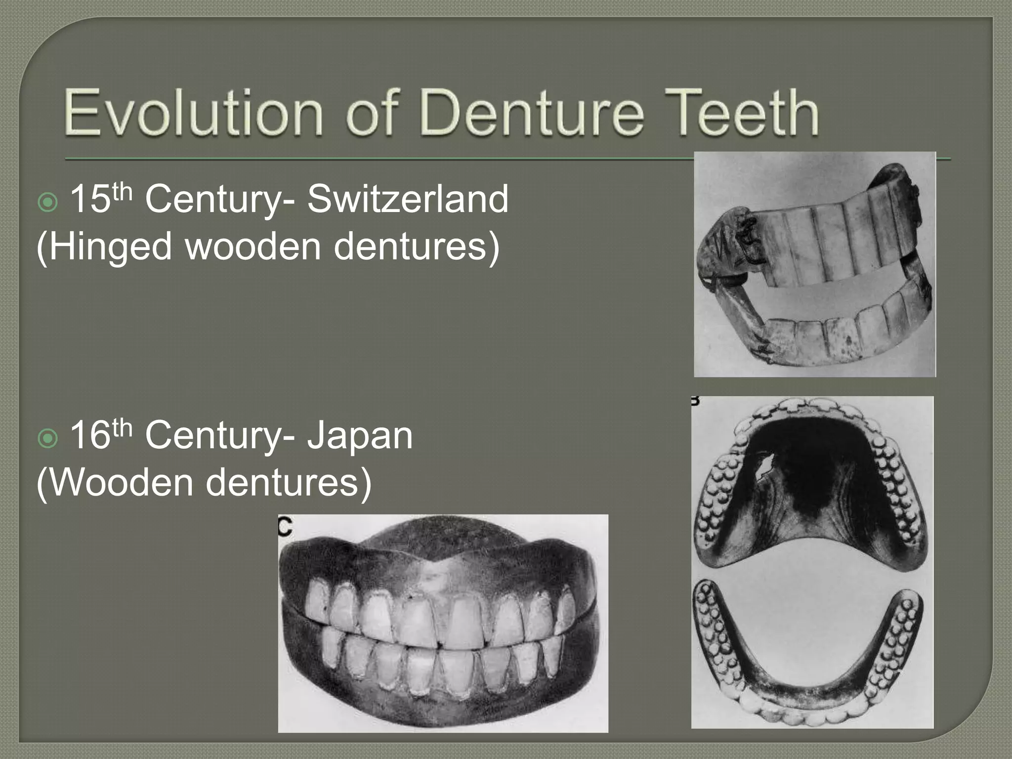 Posterior Teeth Selection in Complete Denture | PPT