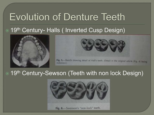Posterior Teeth Selection in Complete Denture | PPT