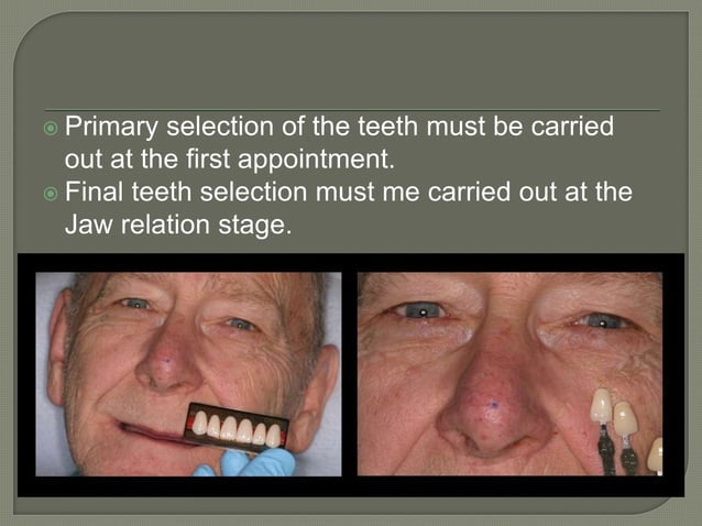 Posterior Teeth Selection in Complete Denture | PPT