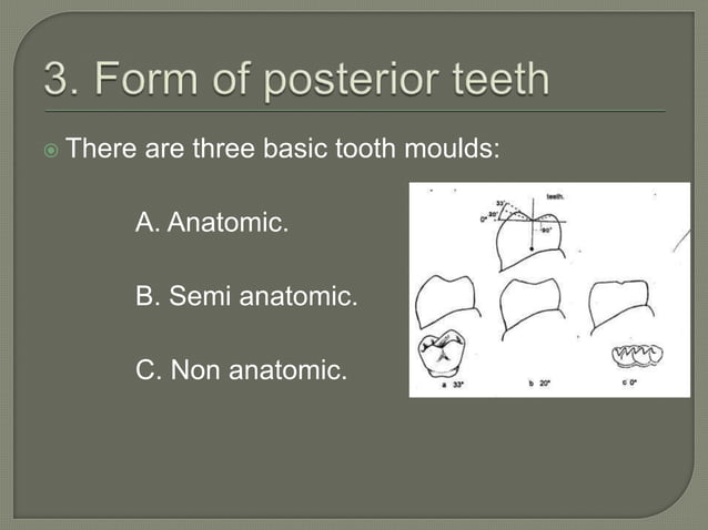 Posterior Teeth Selection in Complete Denture | PPT