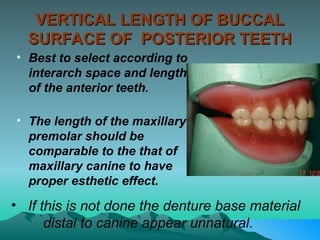 POSTERIOR TEETH SELECTION NEW for teeth arrangement | PPT