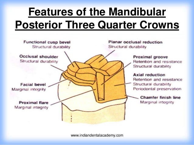 Posterior tooth preparations /certified fixed orthodontic courses by