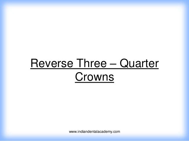 Posterior tooth preparations /certified fixed orthodontic courses by
