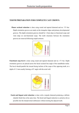 Posterior tooth preparations/dental crown &bridge course by Indian ...