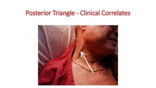 Posterior triangle of neck | PPTX