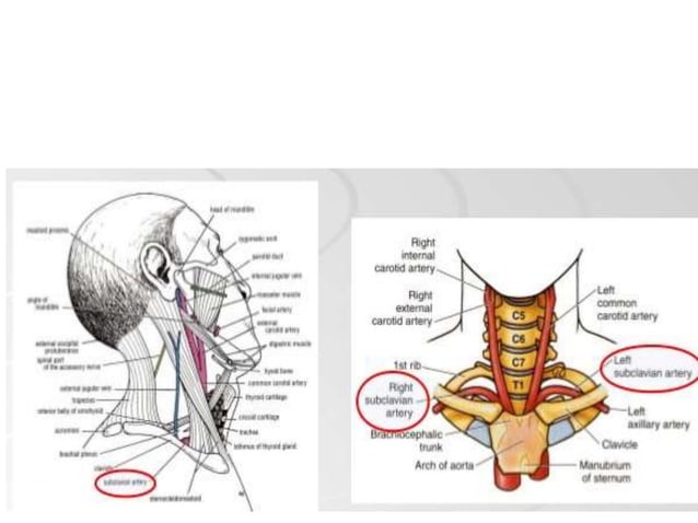 Posterior triangle | PPT