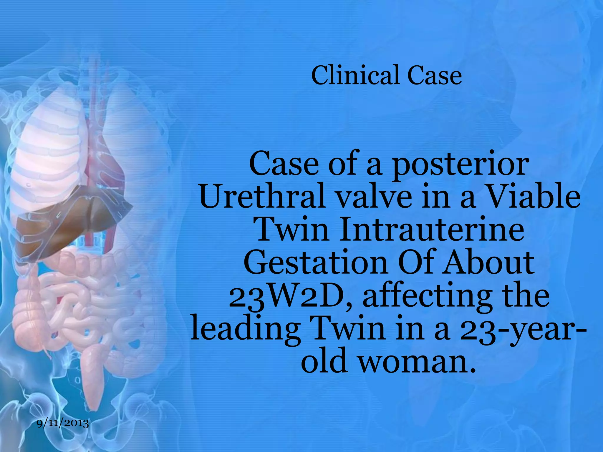 Posterior urethral valve | PPT