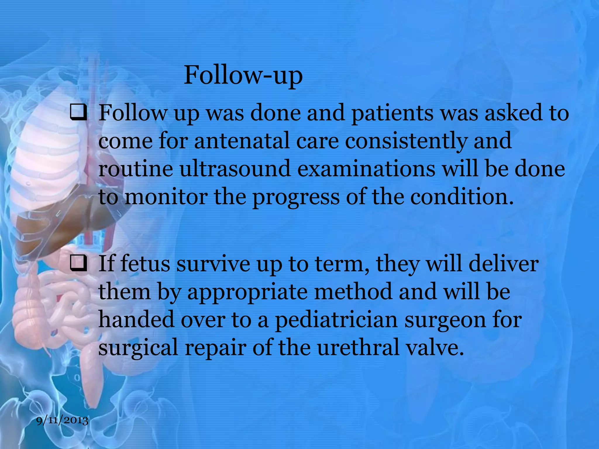 Posterior urethral valve | PPT