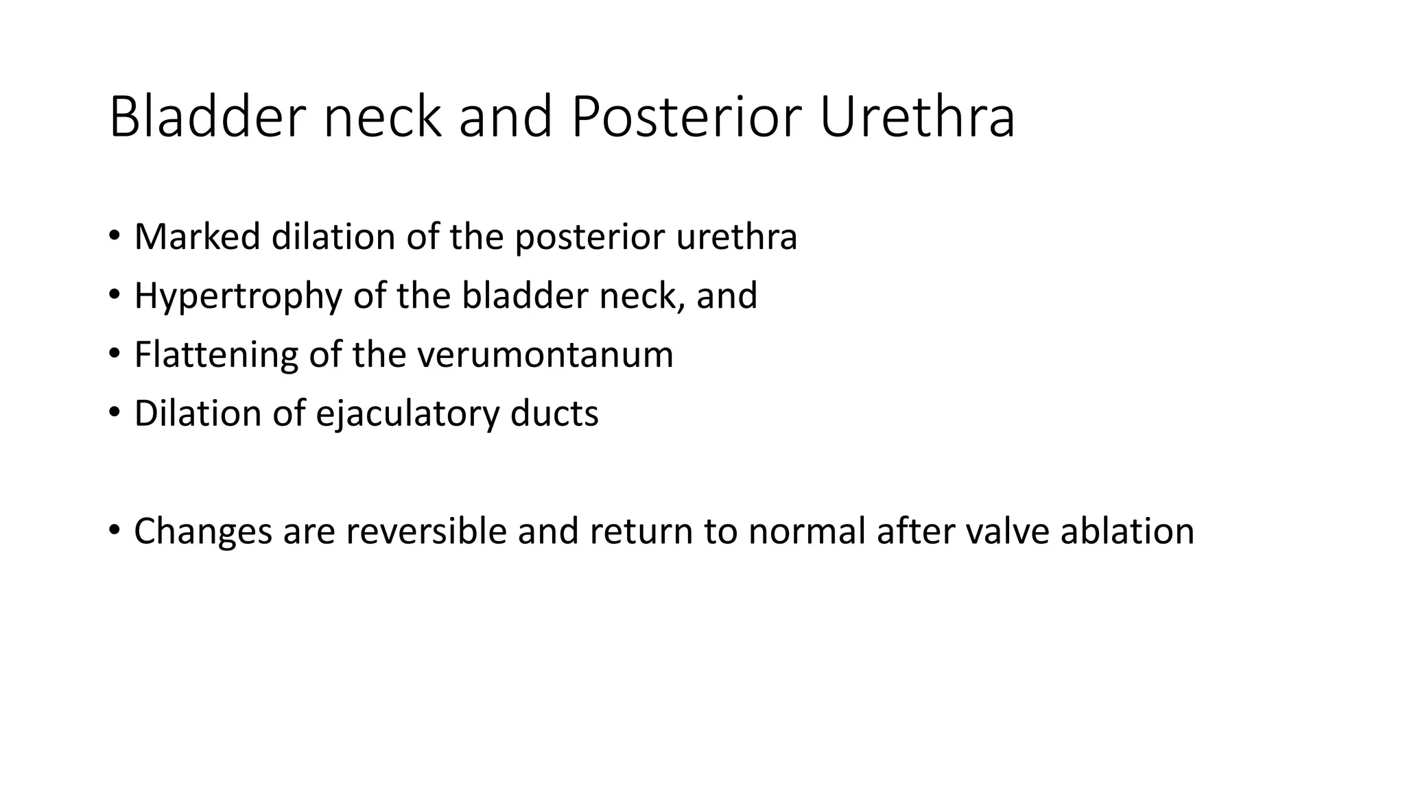 Posterior urethral valve | PPTX