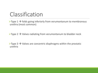 Posterior Urethral Valve | PPTX
