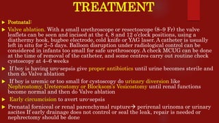 Posterior urethral valves- Pediatric Surgery | PPTX