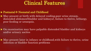 Posterior urethral valves- Pediatric Surgery | PPTX