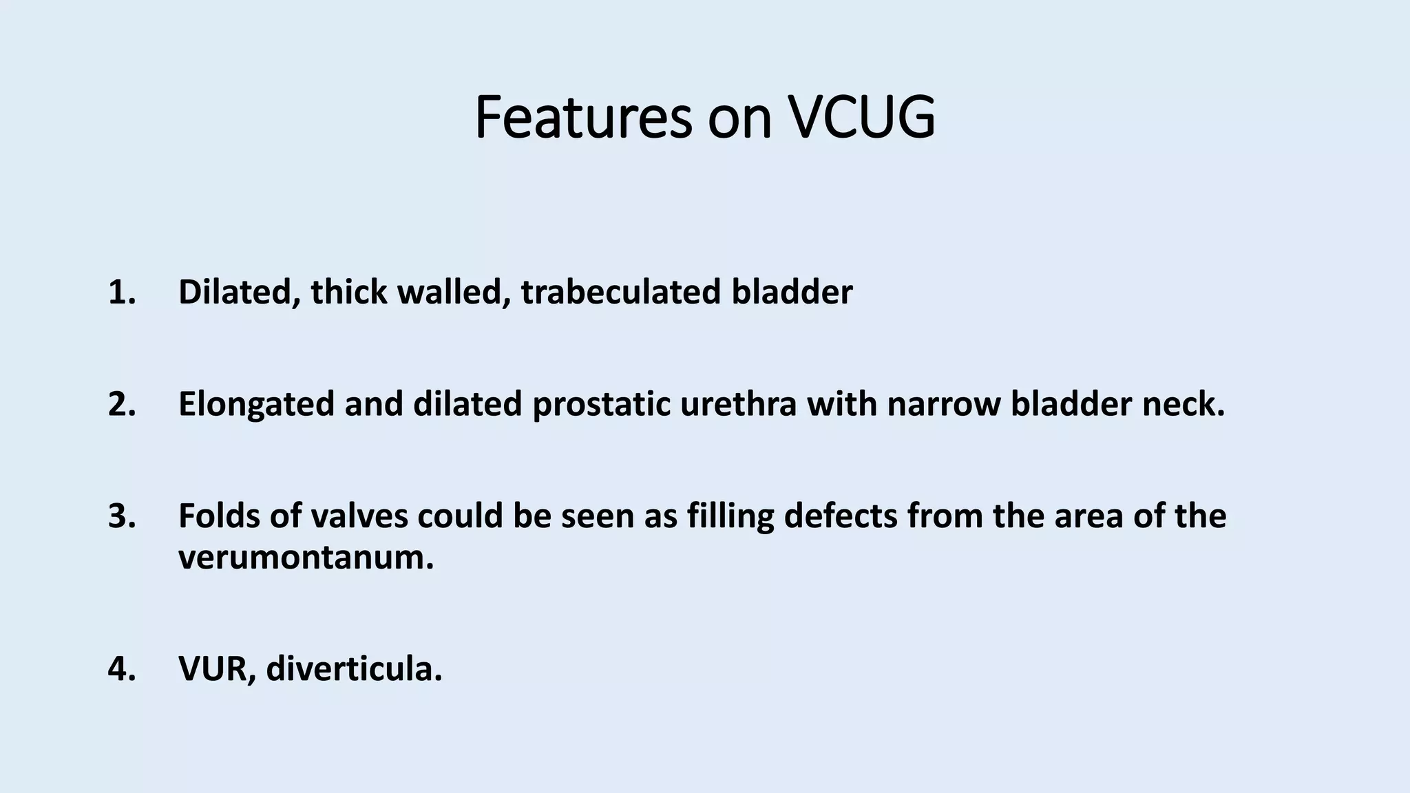 Posterior urethral valves | PPTX