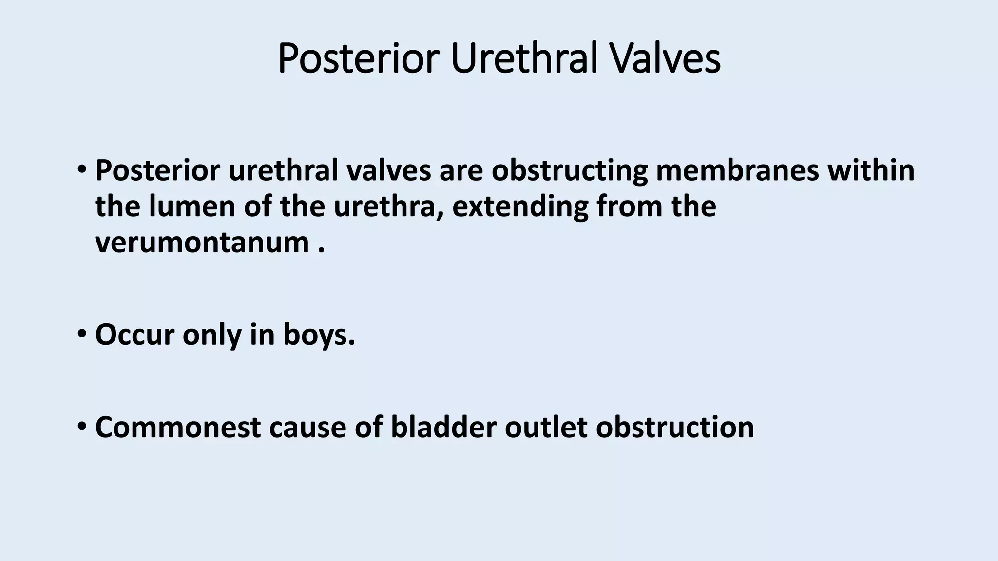 Posterior urethral valves | PPTX